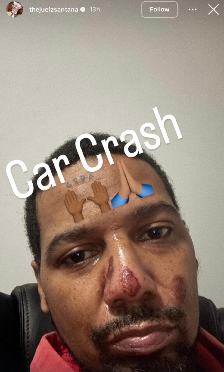Juelz Santana Injured in Car Accident, Shares Graphic Image With Fans ...